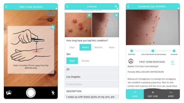 Computer Vision in the Medical Field Transforms Healthcare